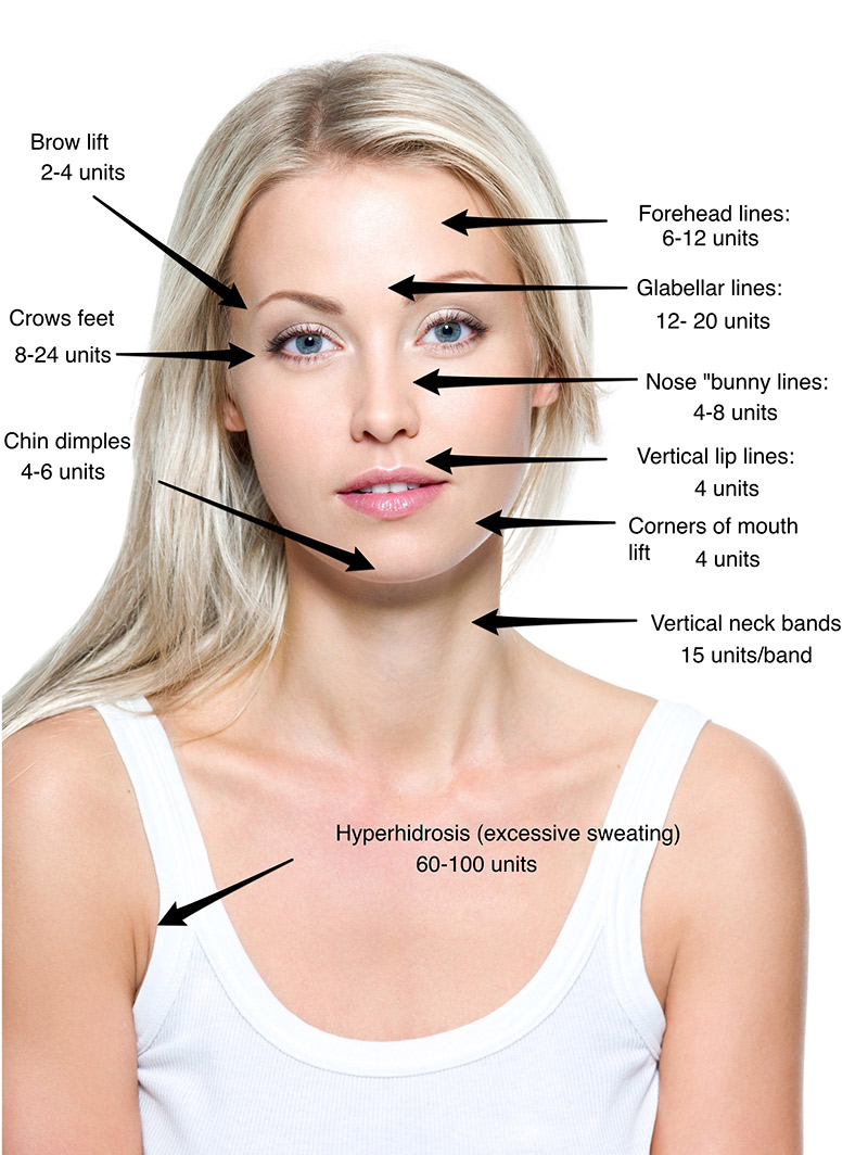 Botox Programe - Peerada-Clinic